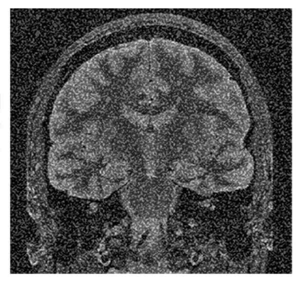 MRI Image Creation and Quality - Medical Professionals