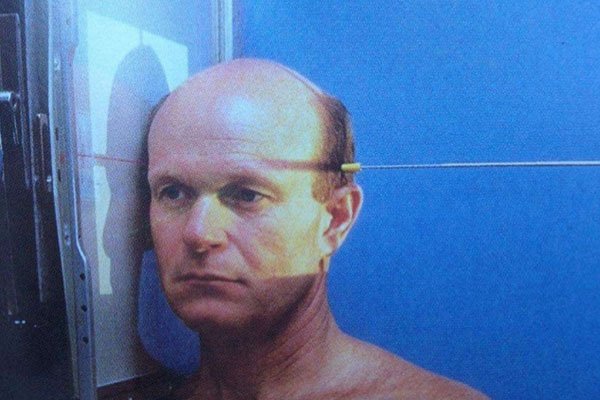 Sinus X-Ray Positioning: An X-Ray Guide - Medical Professionals