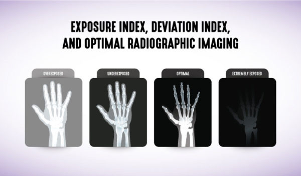 Exposure Index, Deviation Index, & Optimal Radiographic Imaging