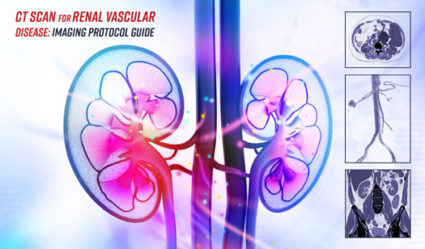 Renal CT Scan for Vascular Diseases: A Complete Imaging Guide