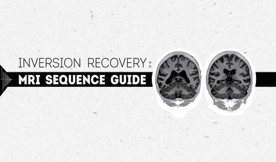 Inversion Recovery: MRI Sequence Guide | Medical Professionals