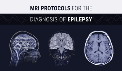 MRI Protocols for Diagnosing Epilepsy | Medical Professionals