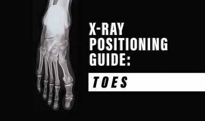 X-Ray Positioning Guide: Toes | Medical Professionals
